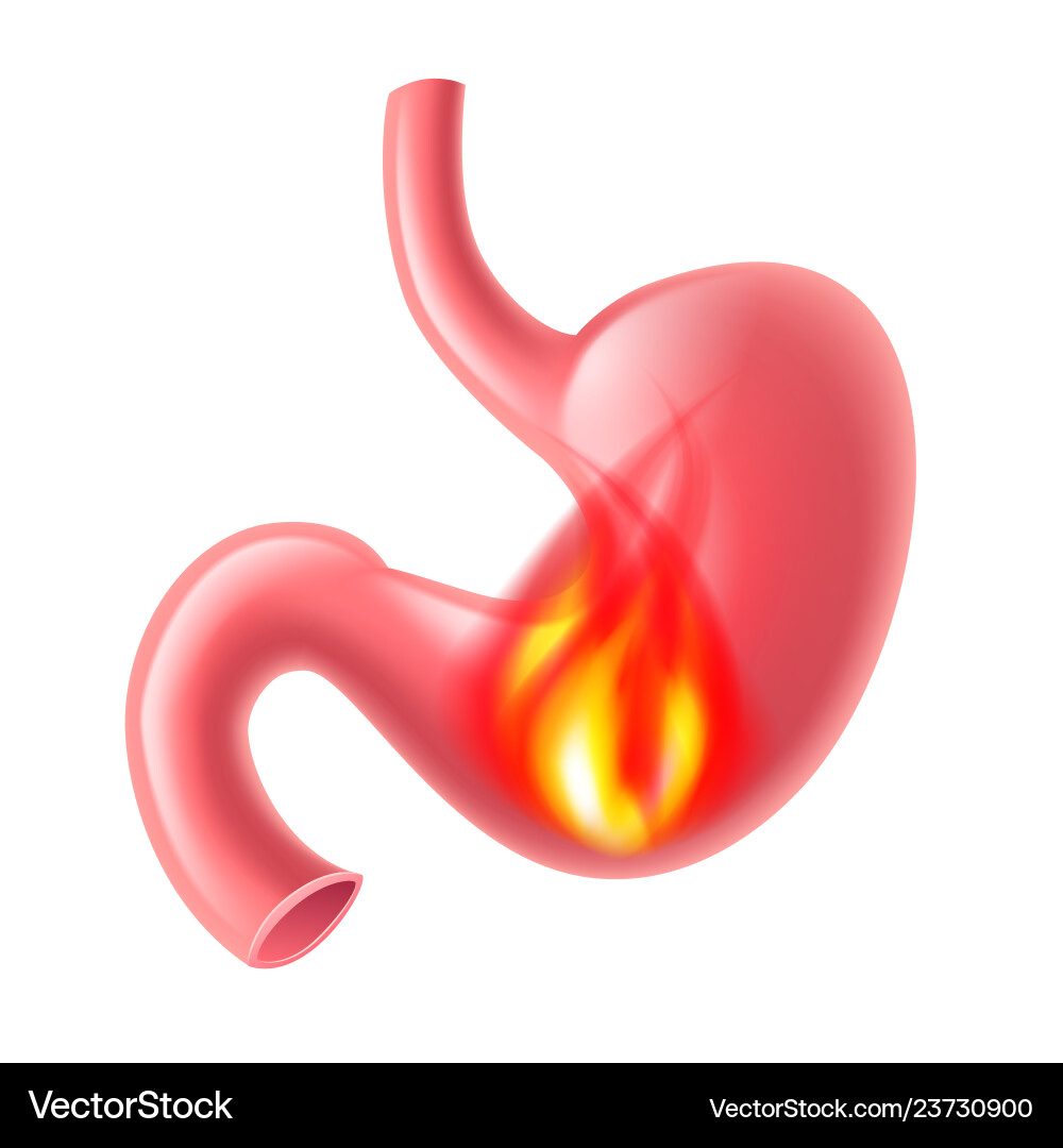 Stomach heartburn isolated on white Royalty Free Vector