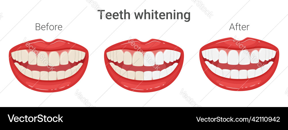 Even yellow and white teeth in the mouth Vector Image