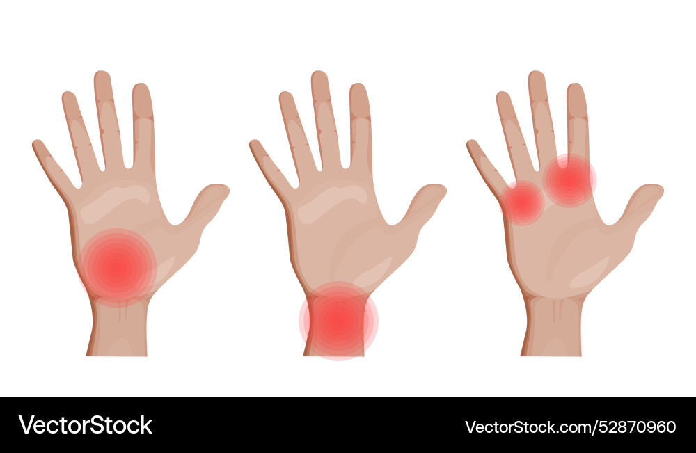 Hand wrist and joint pain Royalty Free Vector Image