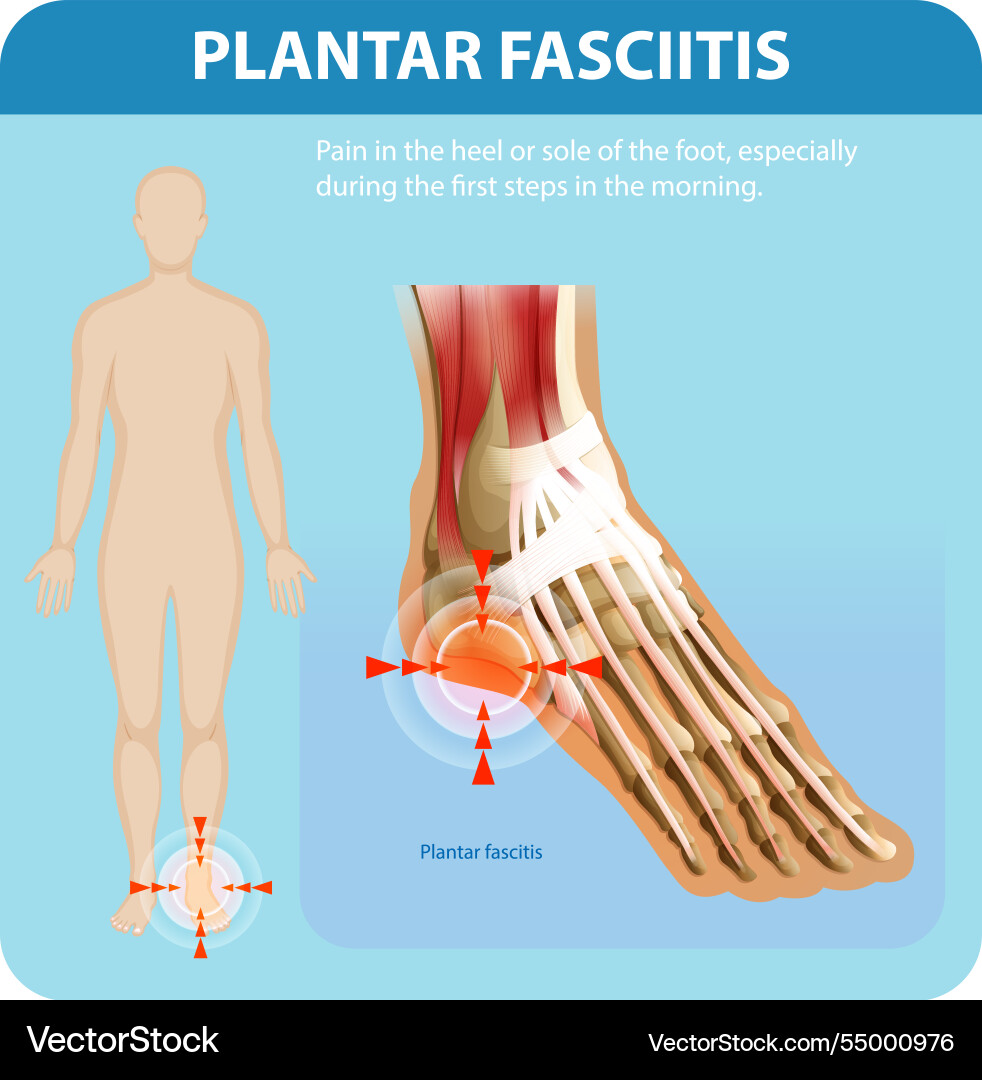 Foot pain and anatomical structure Royalty Free Vector Image