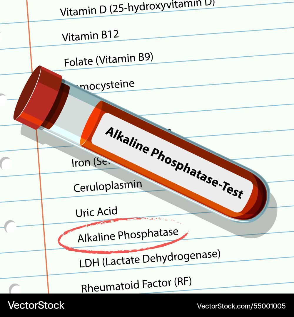 A blood test for alkaline phosphatase Royalty Free Vector