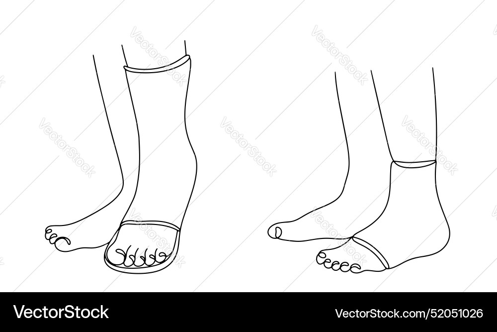 Splint for ankle fractures Royalty Free Vector Image