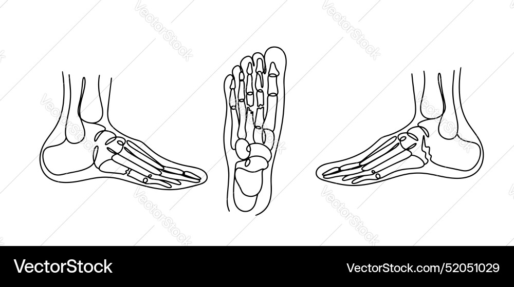 Types of foot fractures Royalty Free Vector Image