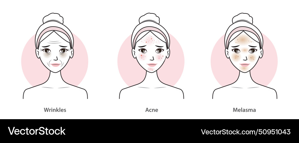 Infographic of skin problems set Royalty Free Vector Image