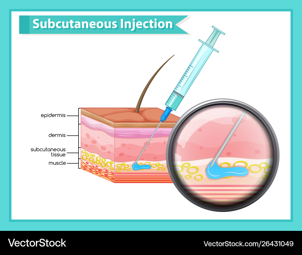 Scientific medical subcutaneous injection Vector Image