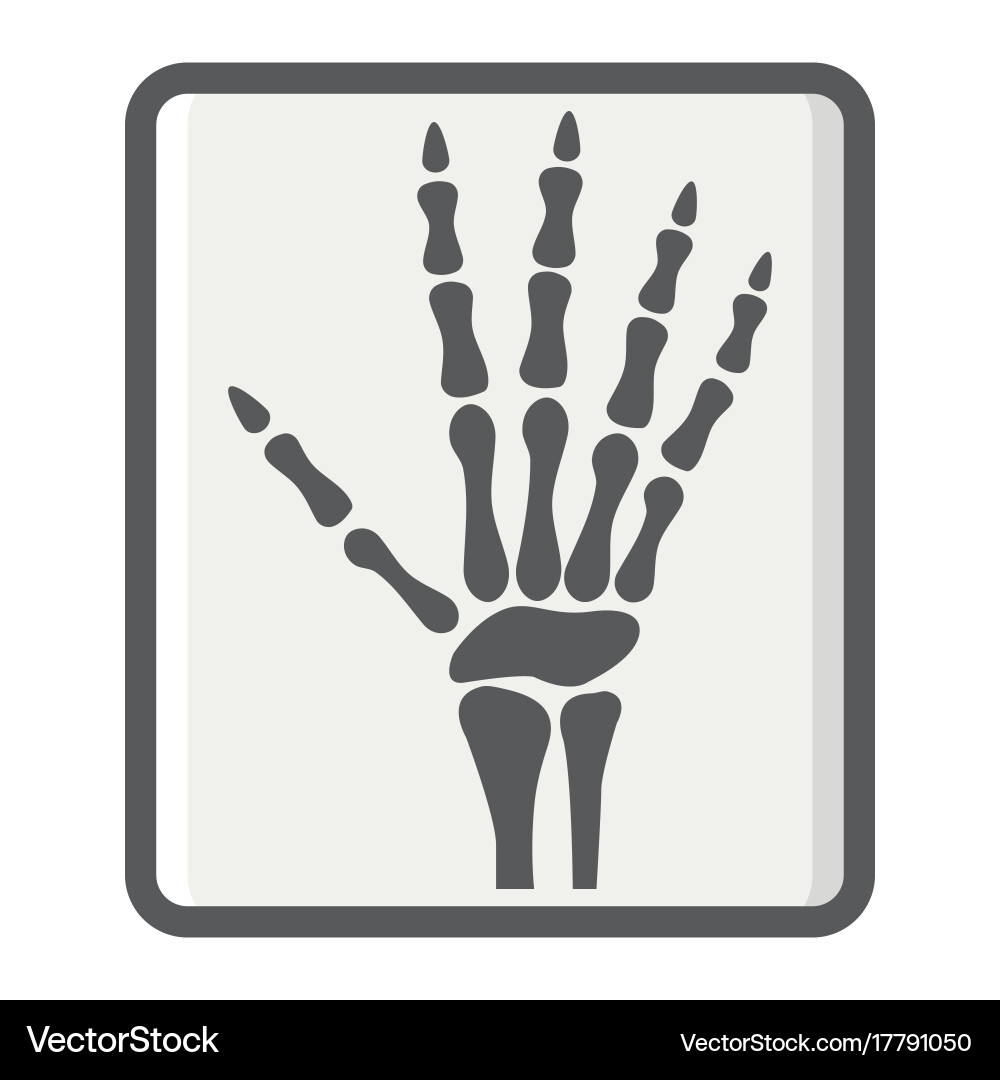 Hand X-Ray Icon - Radiology Royalty Free Vector Image