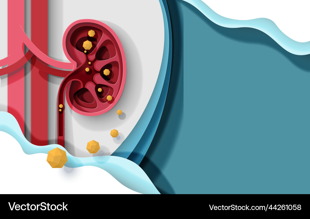 Kidney stone human renal disease background Vector Image