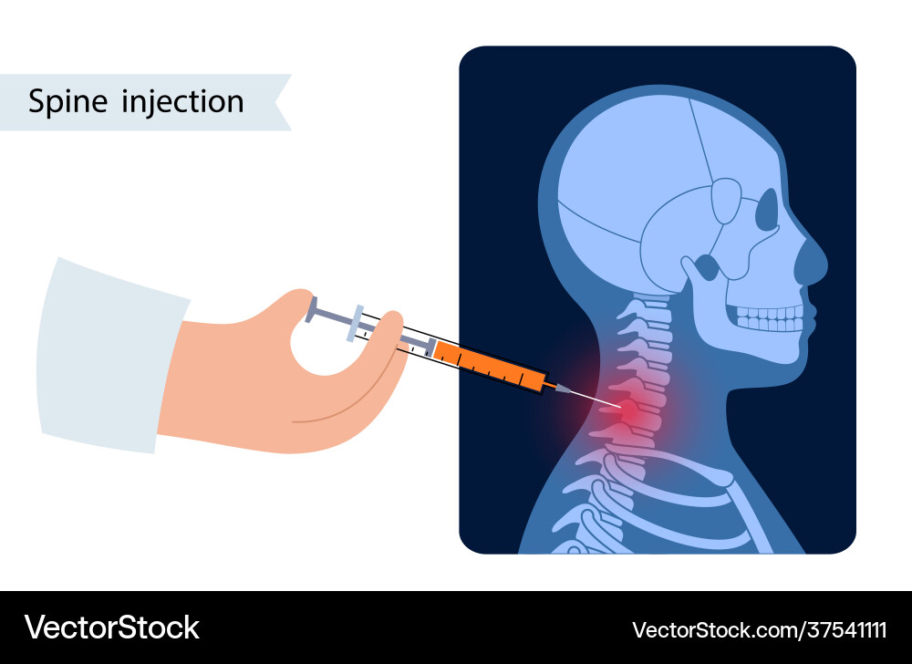 Spine joint injection Royalty Free Vector Image