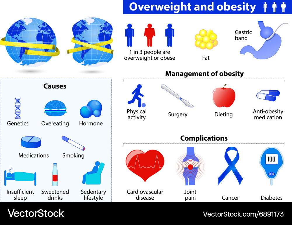 Obesity and Overweight Infographic Royalty Free Vector Image