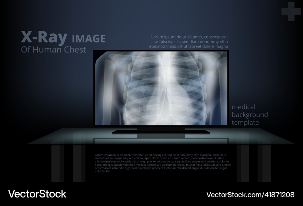 X-ray image of human chest on computer screen Vector Image