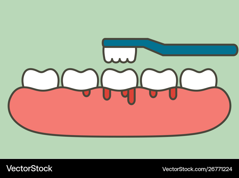 Brushing teeth with bleeding on gum and tooth Vector Image