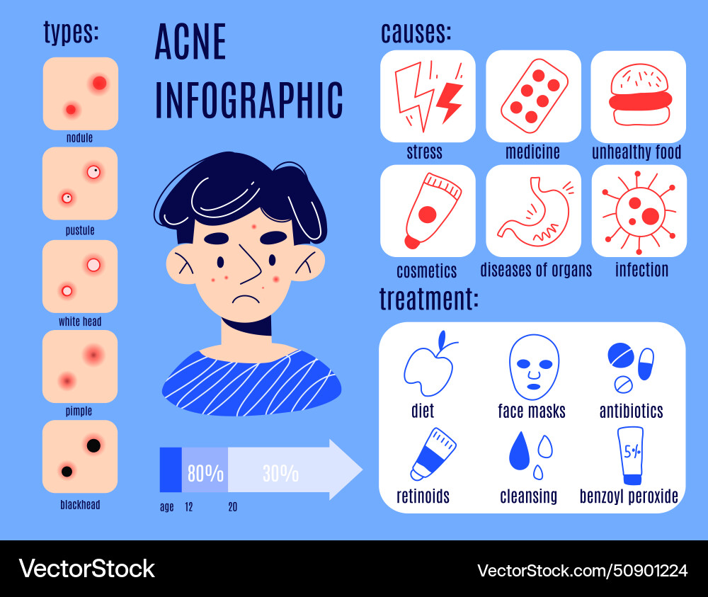 Man problem skin infographic stop acne Royalty Free Vector