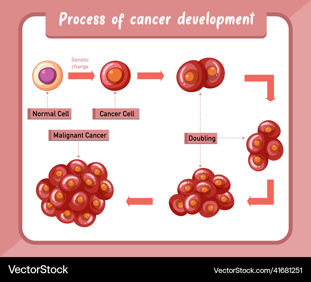 Process of cancer development infographic Vector Image