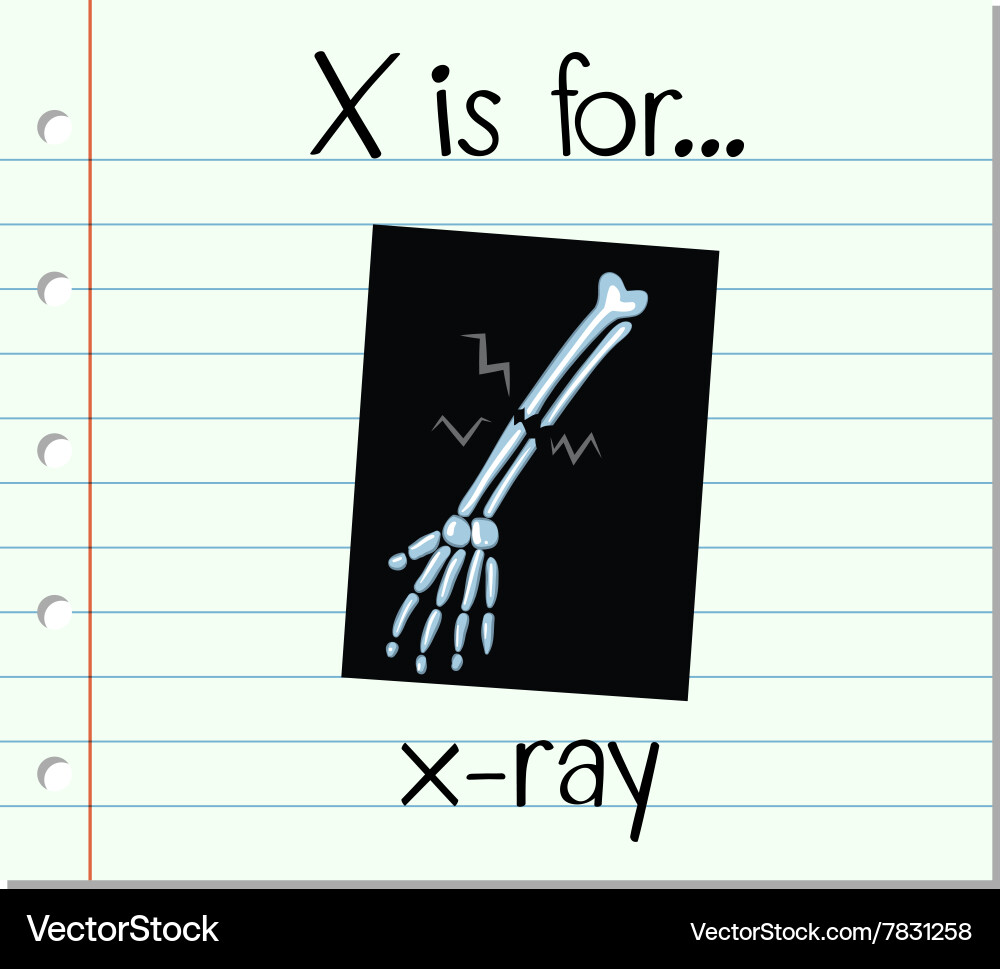 Flashcard letter x is for x-ray Royalty Free Vector Image