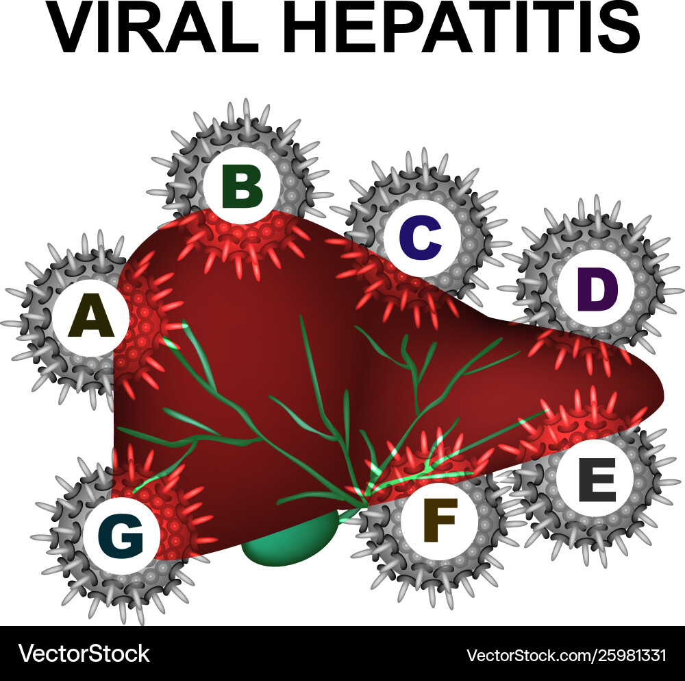 Types viral hepatitis a b c d e Royalty Free Vector Image