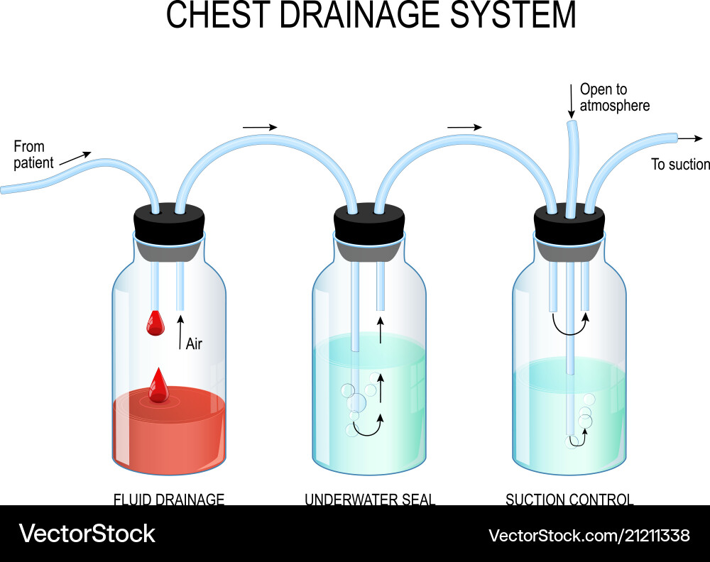 Chest drainage system Royalty Free Vector Image