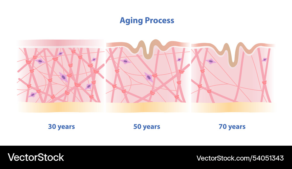 Cross section of aging process skin comparison Vector Image