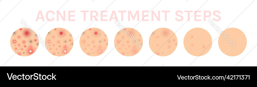 Icon problem skin with pimples treatment Vector Image