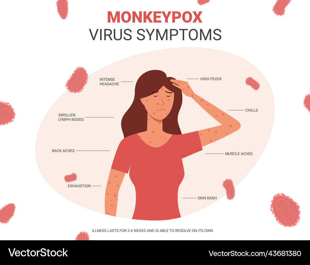 Banner with monkeypox virus symptoms Royalty Free Vector