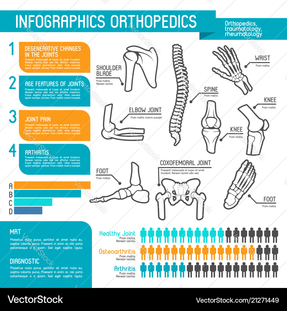 Orthopedics medicine statistic infographic design Vector Image