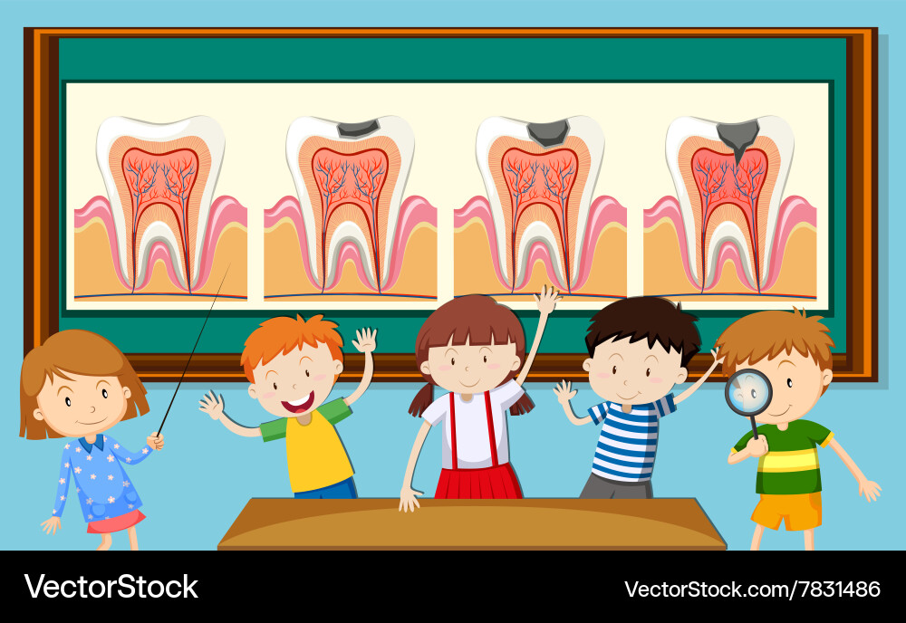 Children and tooth decay diagram Royalty Free Vector Image
