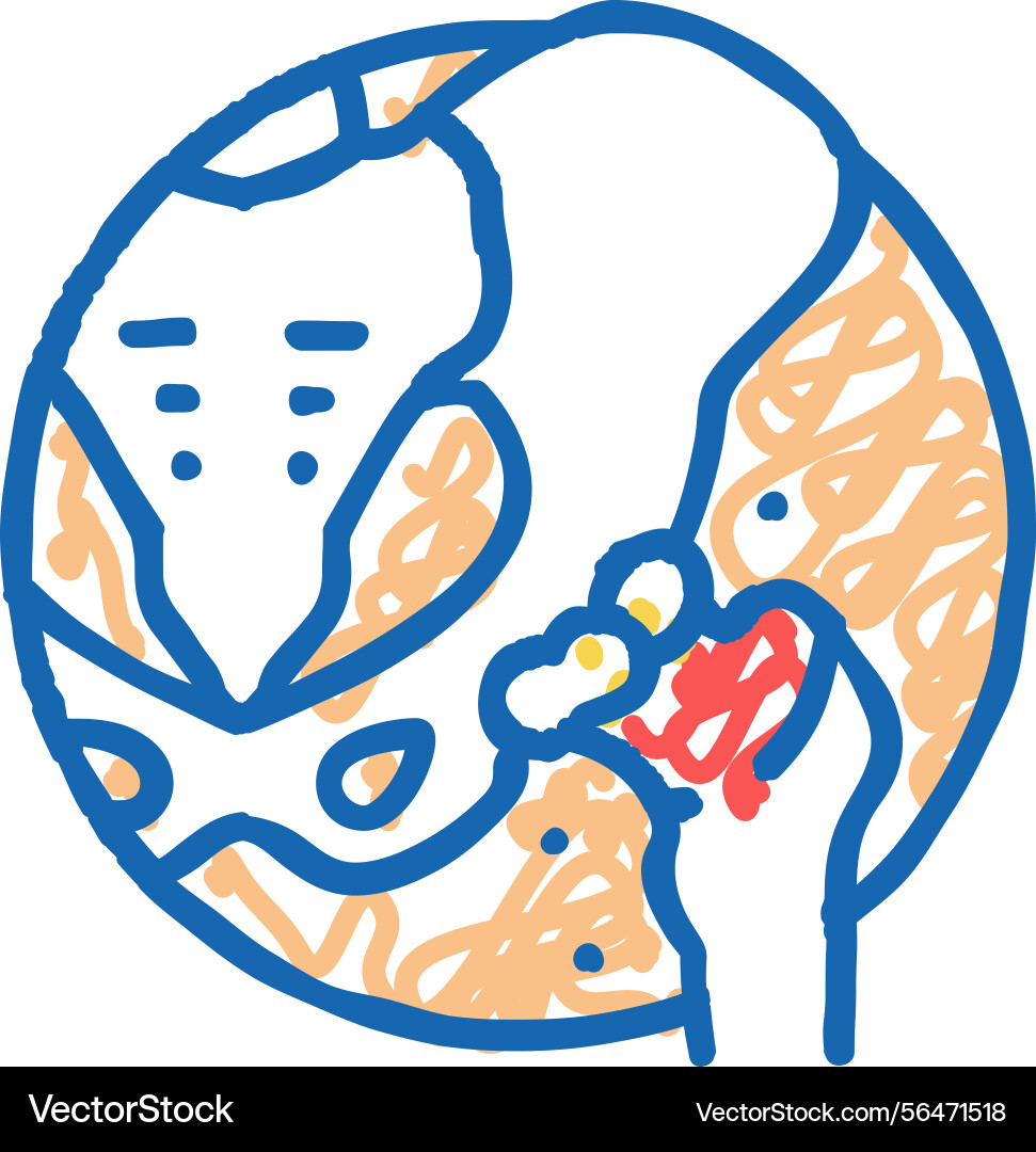Articular cartilage gout icon doodle Royalty Free Vector