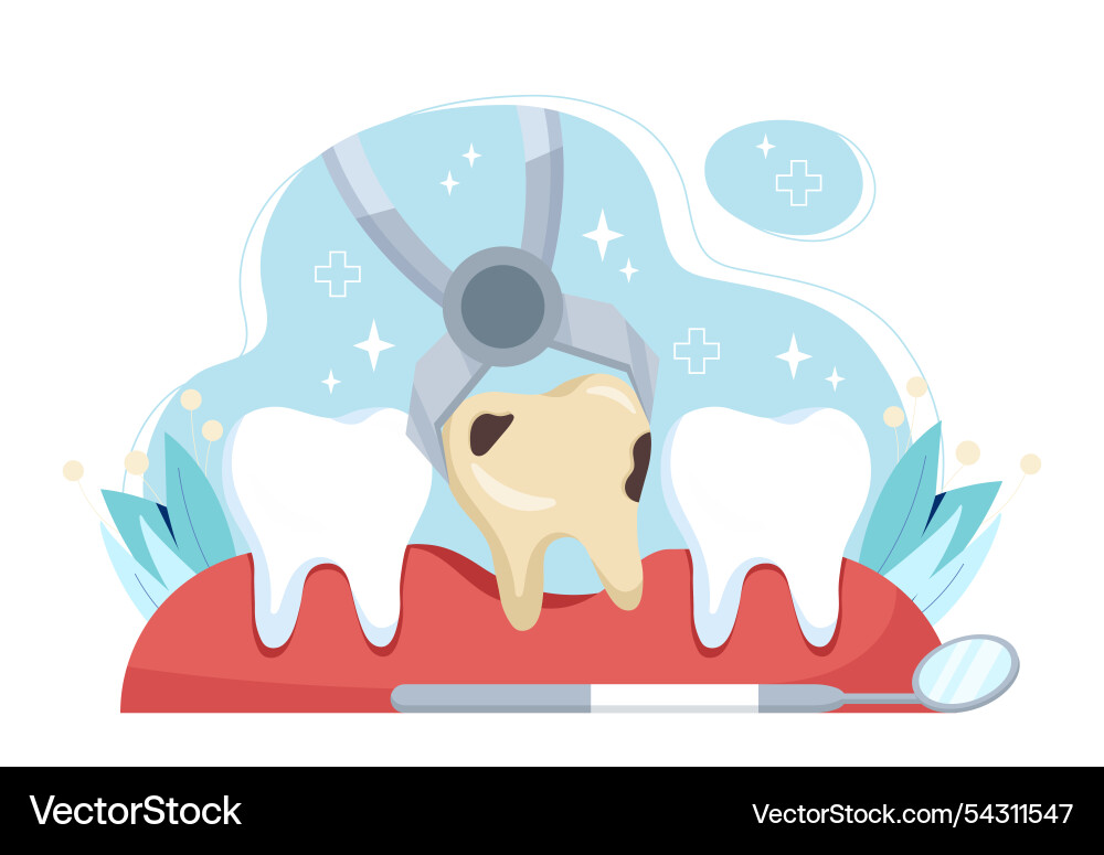 Tooth extraction concept forceps remove Royalty Free Vector