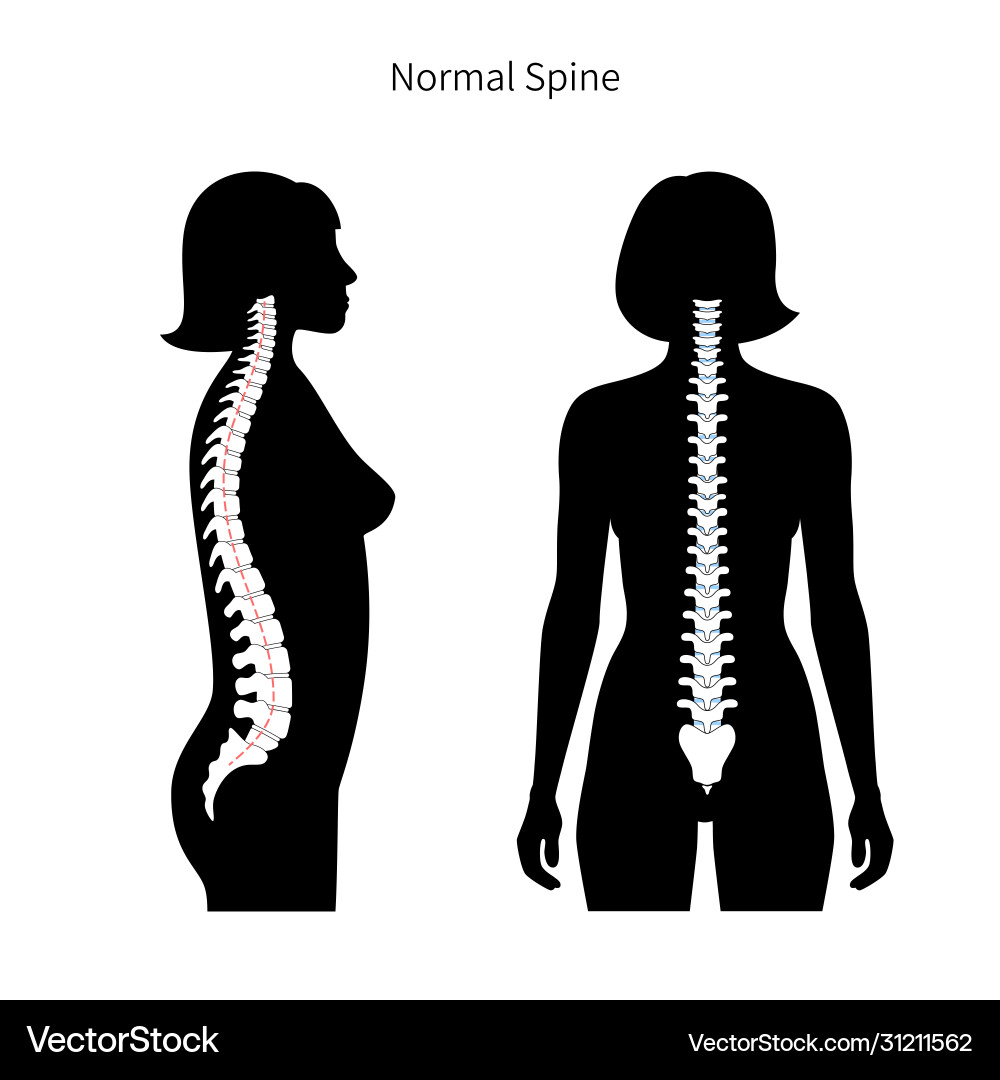 Woman healthy spine Royalty Free Vector Image - VectorStock