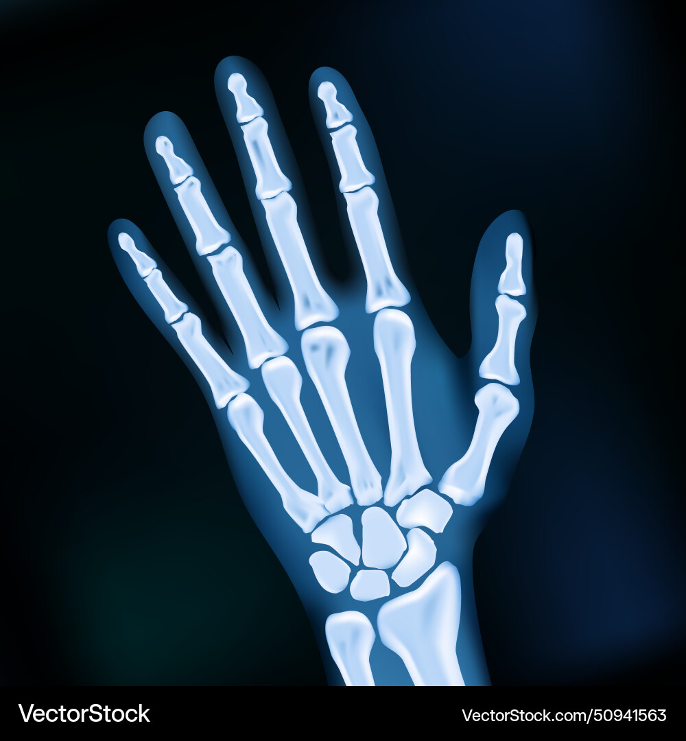 Realistic 2d x-ray hand dark medical image Vector Image