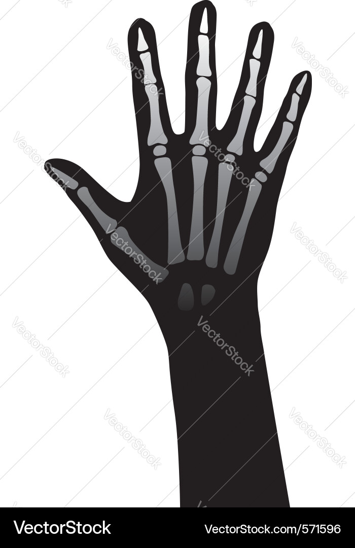 Hand X-Ray Image Royalty Free Vector Image - VectorStock