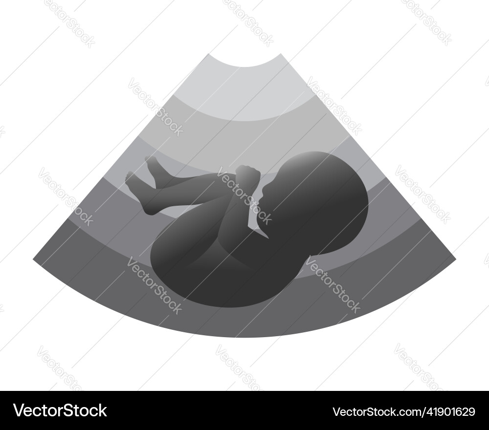 Fetal ultrasound Royalty Free Vector Image - VectorStock