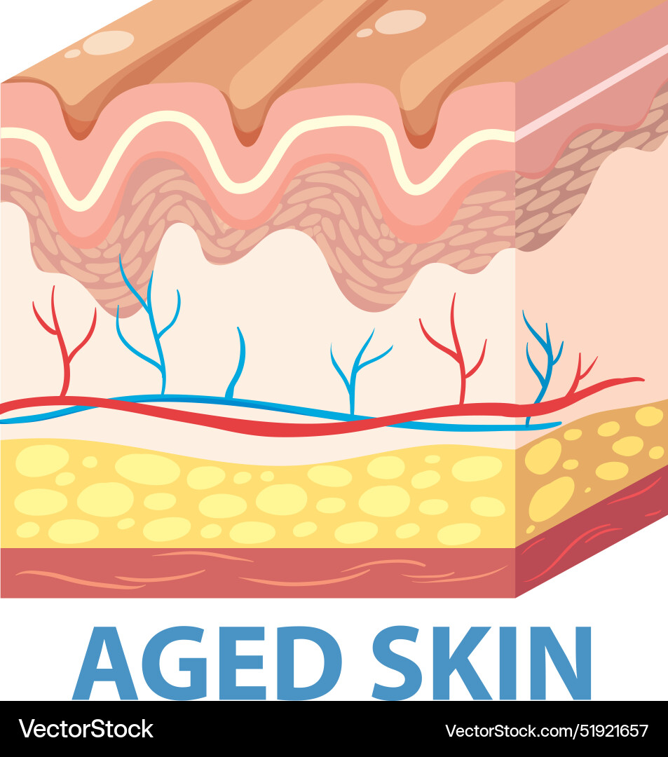 Cross-section showing aged skin structure Vector Image