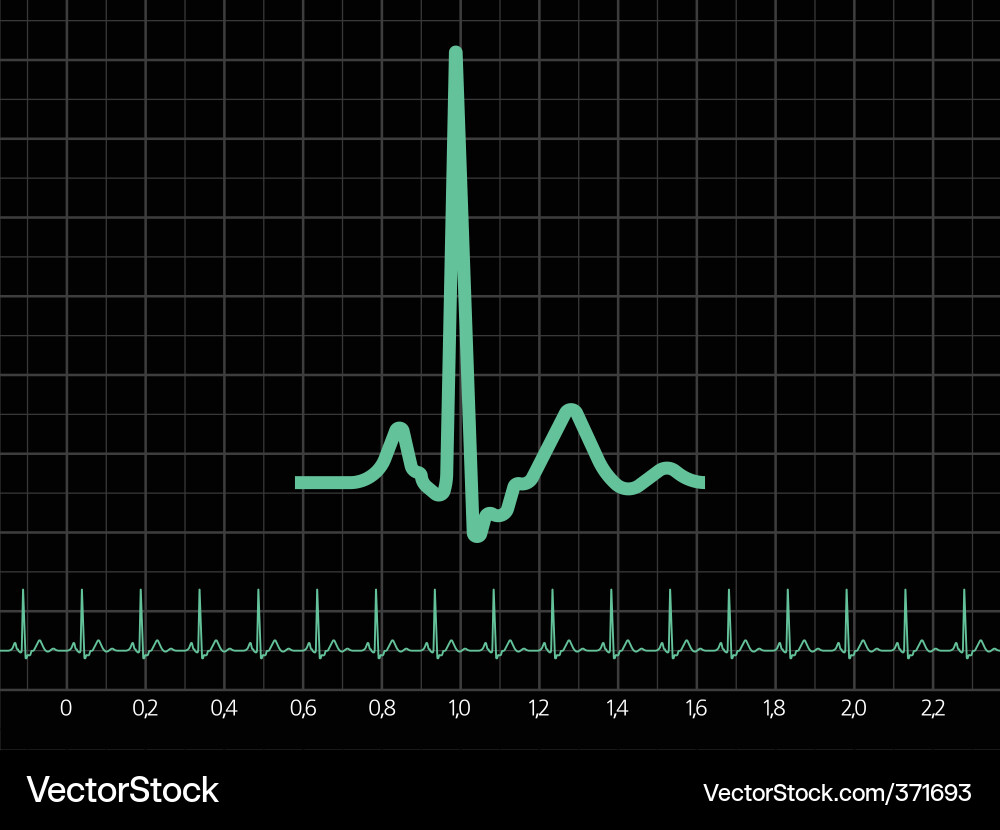 Electrocardiogram ekg Royalty Free Vector Image