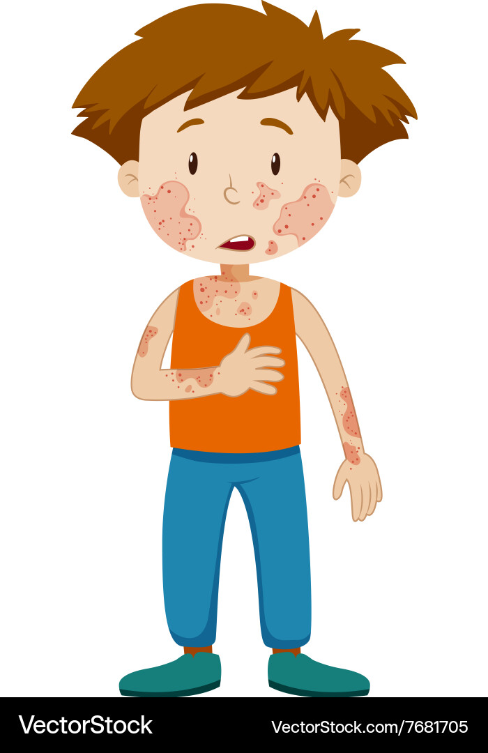 Boy with infectious disease Royalty Free Vector Image