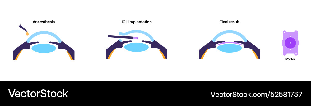 Evo icl poster Royalty Free Vector Image - VectorStock
