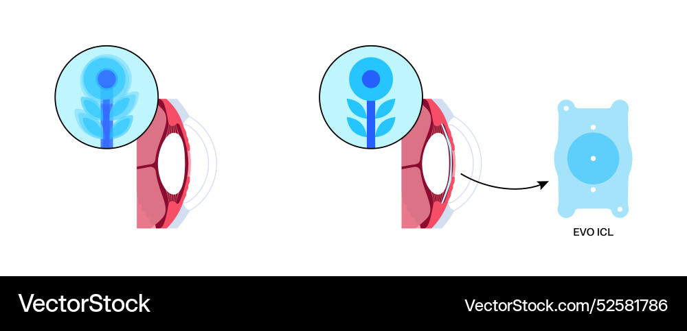 Evo icl poster Royalty Free Vector Image - VectorStock