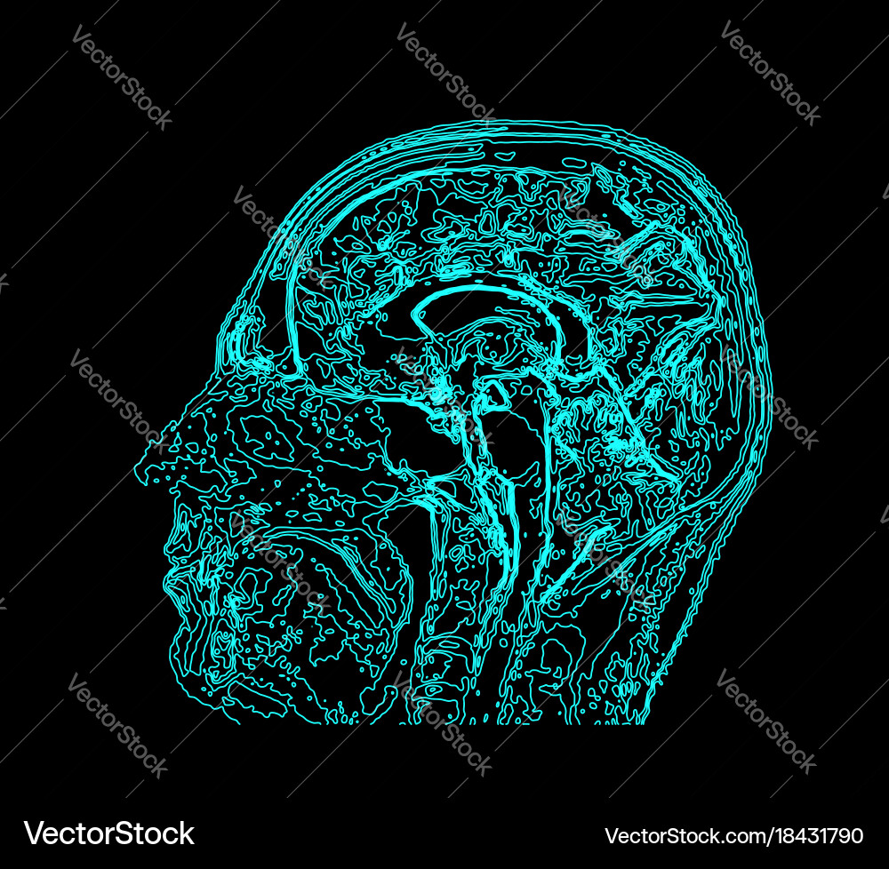 Topographic map mri of the human brain Royalty Free Vector