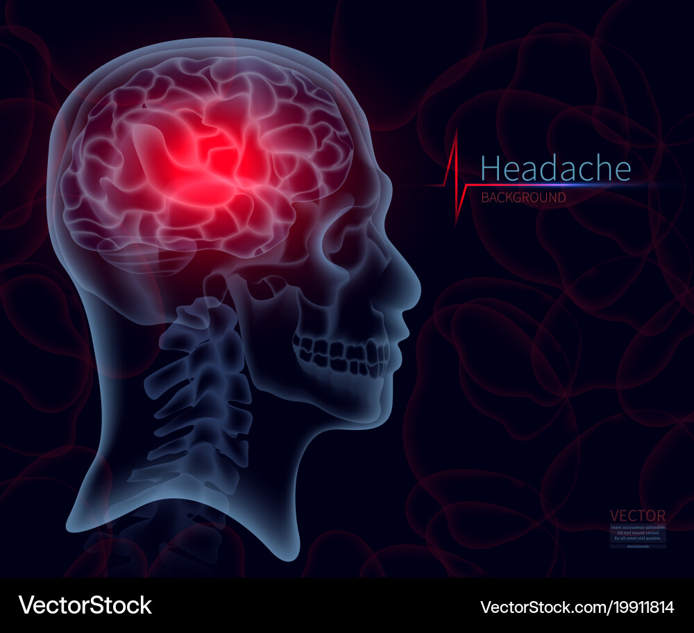 X-Ray Skull - Brain Scan Royalty Free Vector Image