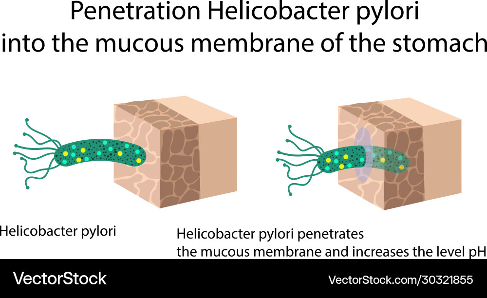 Helicobacter pylori Royalty Free Vector Image - VectorStock