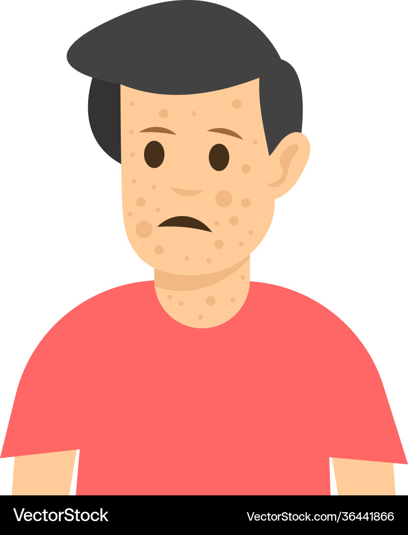 Chickenpox Royalty Free Vector Image - VectorStock