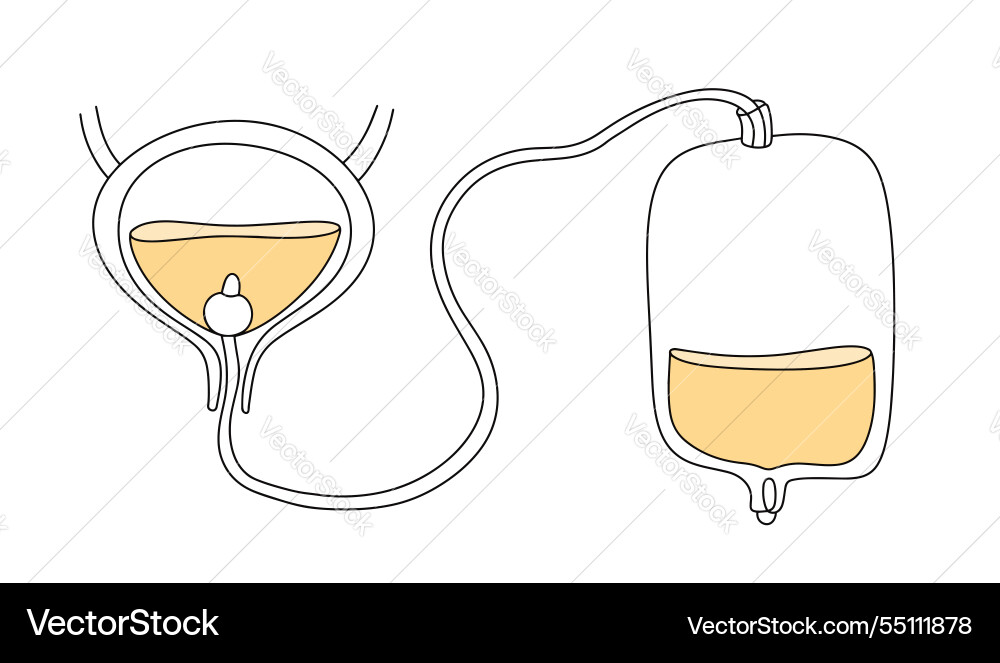 Urinary catheter Royalty Free Vector Image - VectorStock