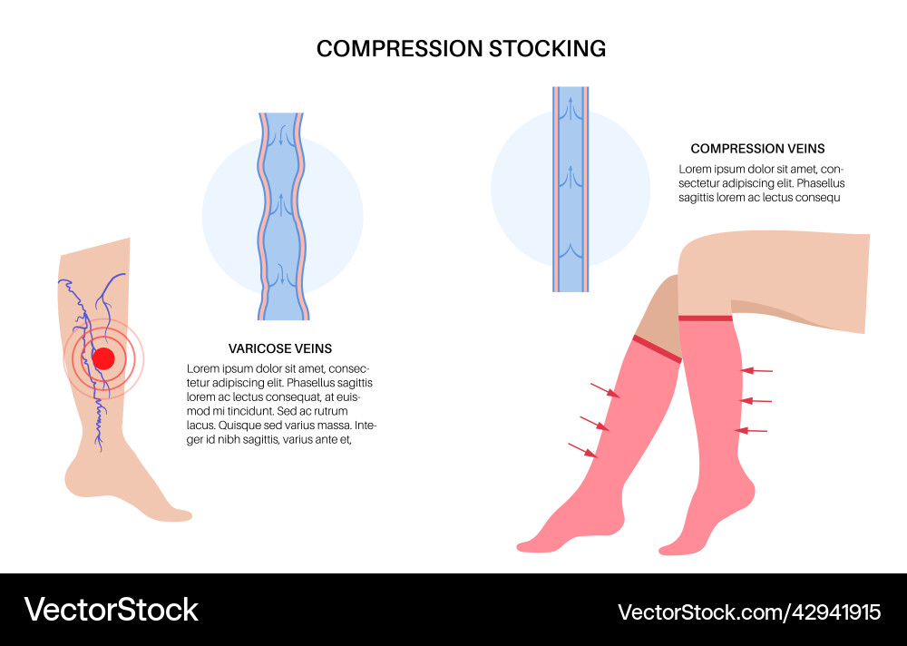 Compression Stocking for Varicose Veins Royalty Free Vector