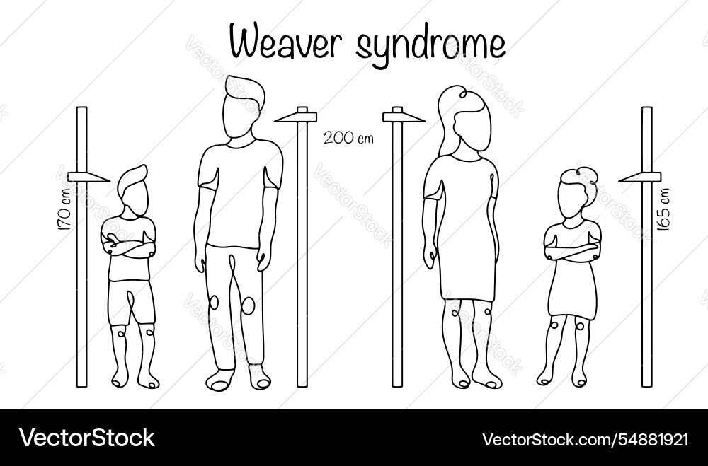 Weaver syndrome Royalty Free Vector Image - VectorStock