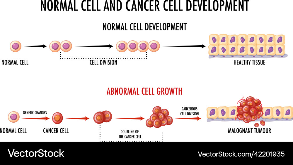 Diagram showing normal and cancer cell Royalty Free Vector