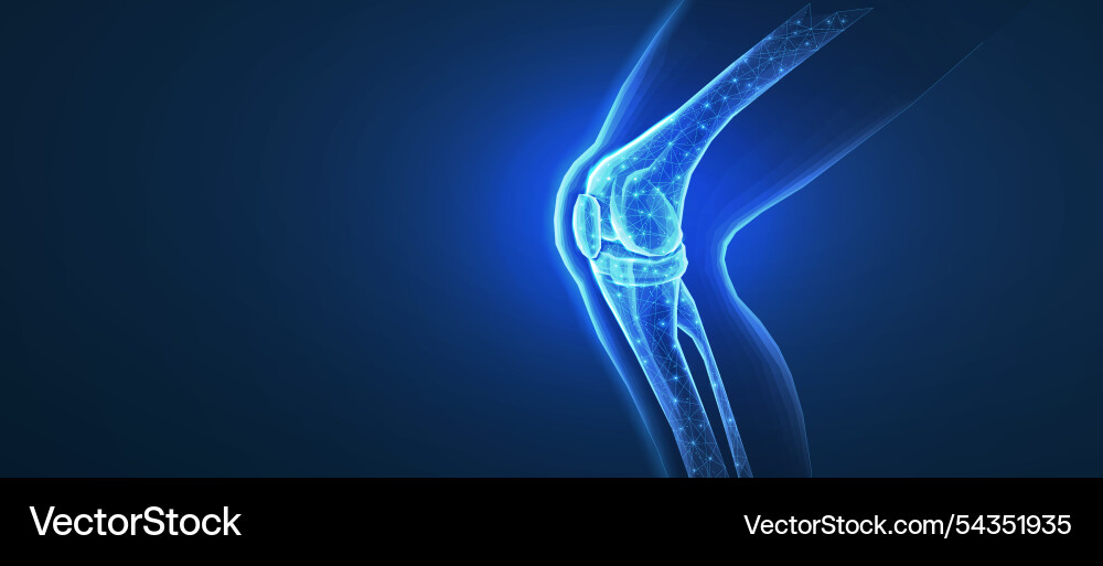 Osteoarthritis Vector Images (over 3,300)
