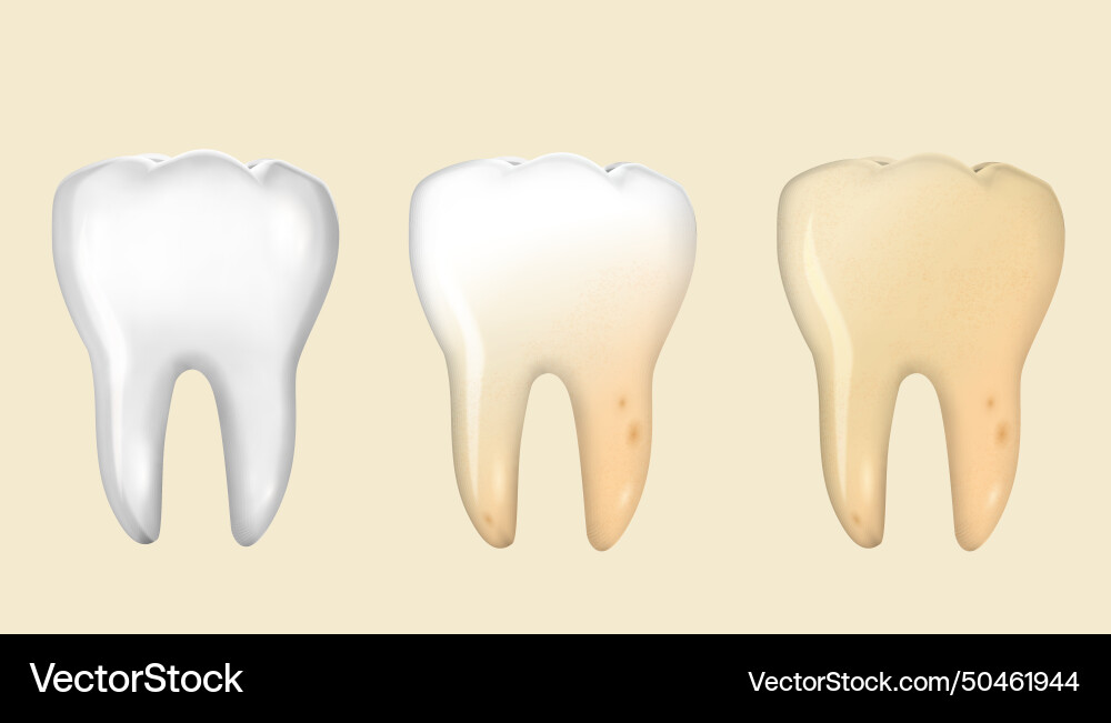 Teeth mock-up set Royalty Free Vector Image - VectorStock