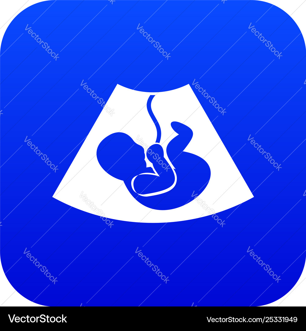 Ultrasound fetus icon digital blau Lizenzfreies Vektorbild