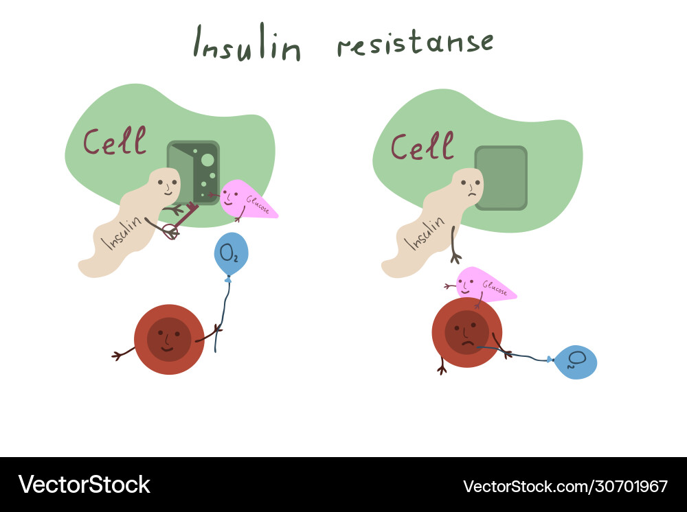 Insulin resistance Royalty Free Vector Image - VectorStock