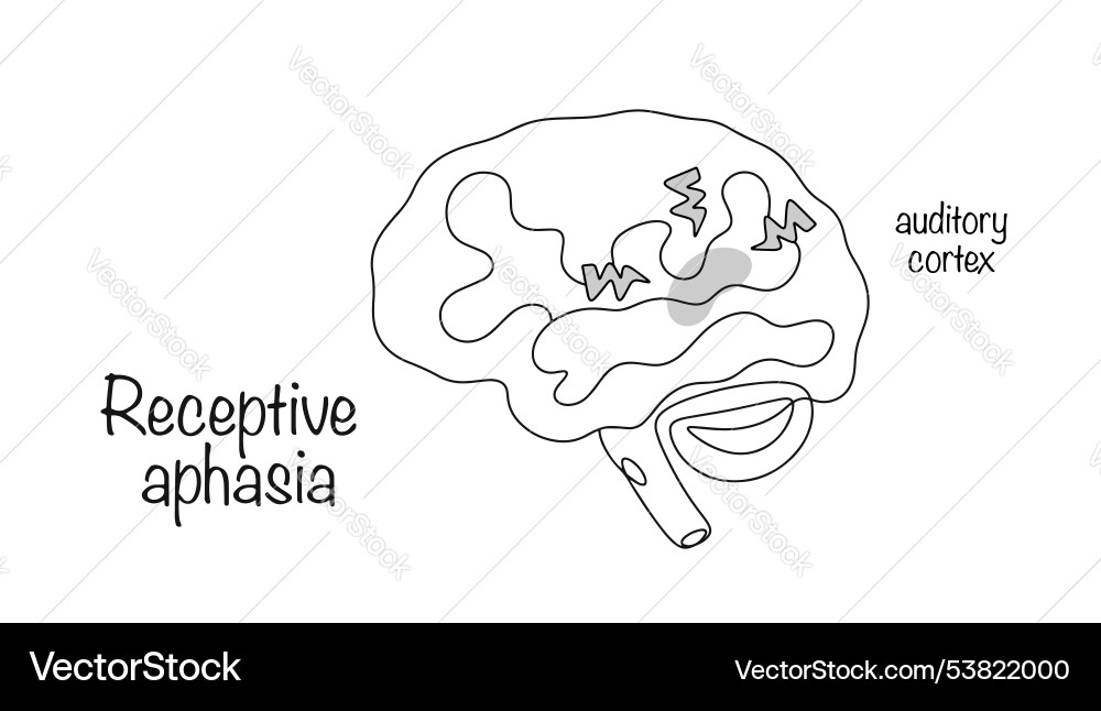 Receptive aphasia Royalty Free Vector Image - VectorStock
