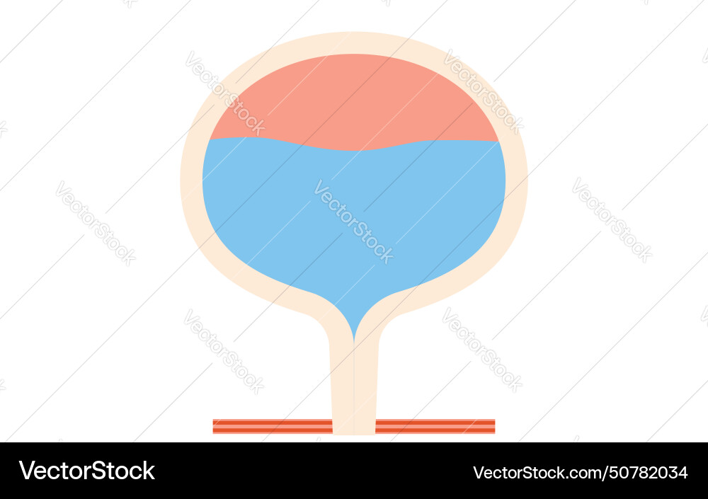 Medical of overactive bladder a condition Vector Image